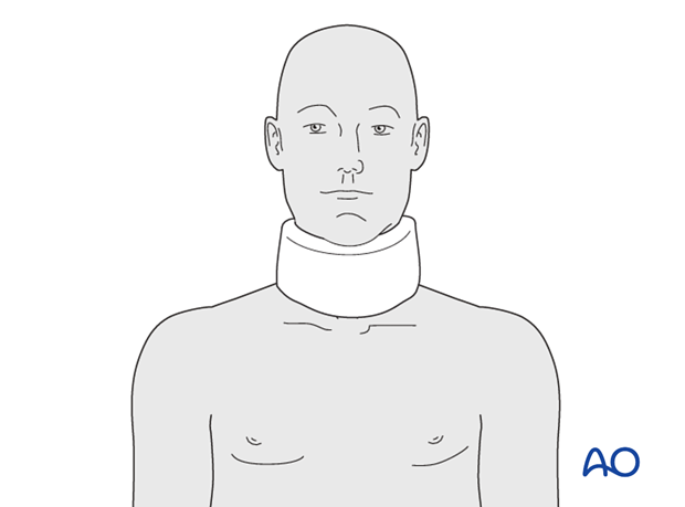 A4 Burst fracture or sagittal split involving both endplates for Burst ...