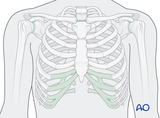 Construction of mandibular ramus and condyle for Pruzansky IIb